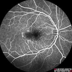 Heidelberg Engineering Spectralis HRA-OCT | Medical Workshop